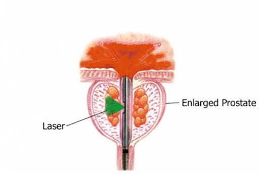 Dr. Naresh Garg: Pioneering Urology Care in Jaipur | by Dr. Naresh Kumar Garg | Apr, 2024 | Medium