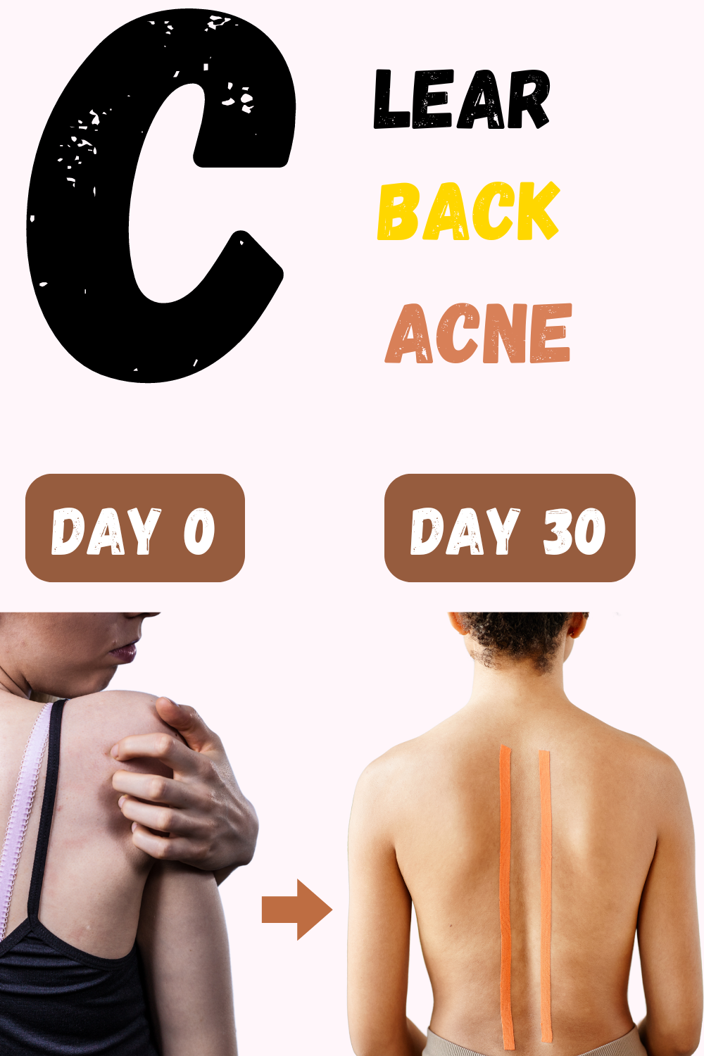 How to Get Rid of Open Pores Naturally at Home 🌿 | by Petaldreams | Sep, 2024 | Medium