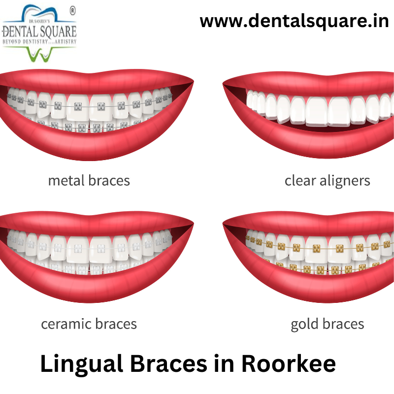 Best Dentist For Tooth Extraction | Dental Square - Dentalsquare - Medium