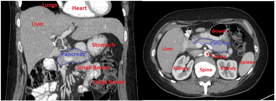 A Python script to sort DICOM files | by Alexander Weston, PhD | Towards Data Science