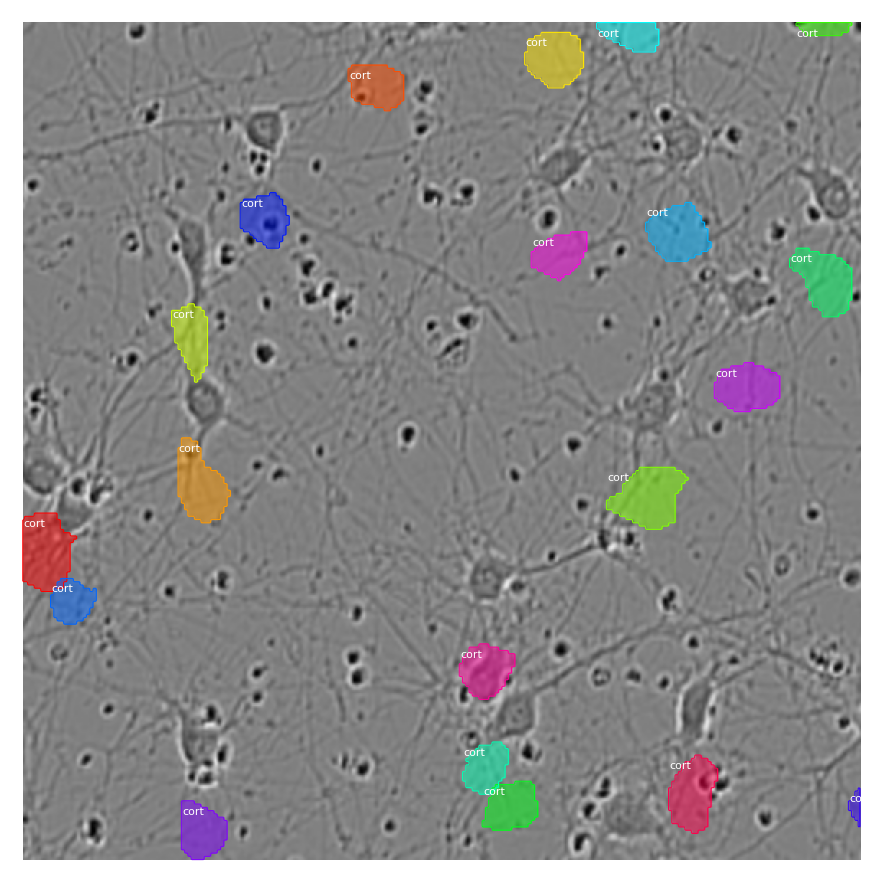Understanding Evaluation Metrics in Medical Image Segmentation | by ...