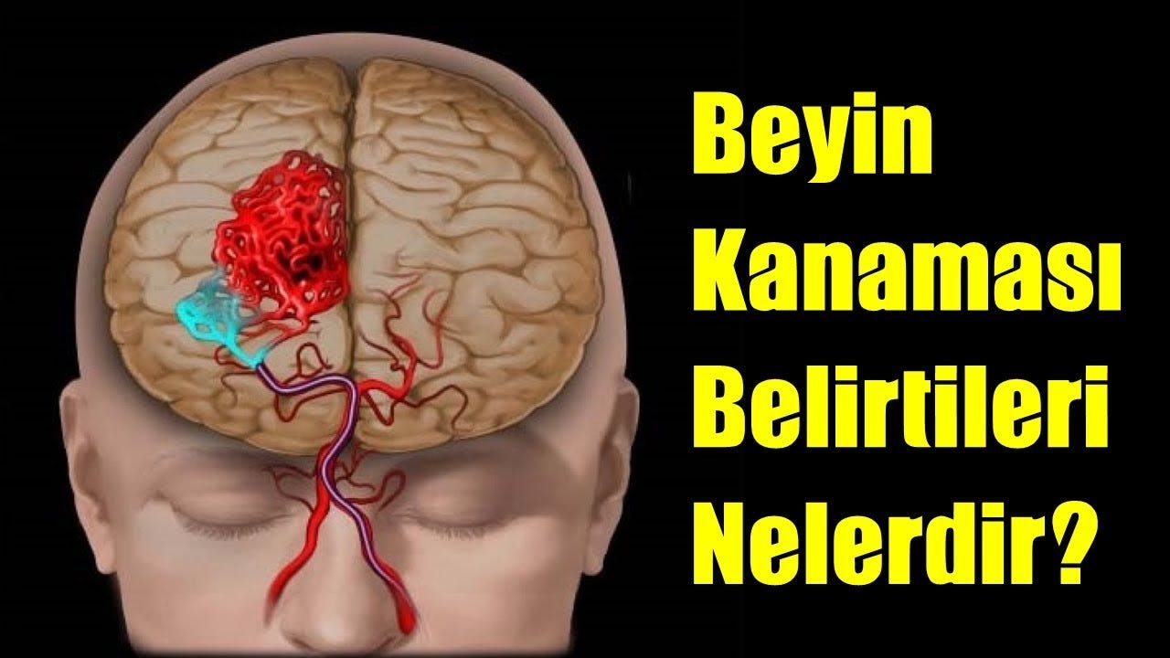 Mastoidit Nedir? Belirtileri Nelerdir? Neden Olur? | by Prof. Dr. Mustafa Özateş | May, 2024 ...