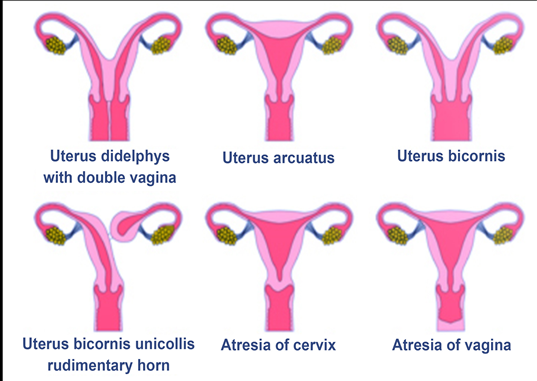 Recurrent Implantation Failure: Causes, Symptoms and Treatment | by ...