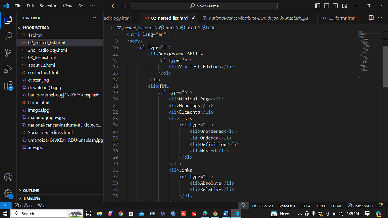 Eating That Frog with the Pomodoro Technique: A Productivity Journey | by Noor Fatima | May ...