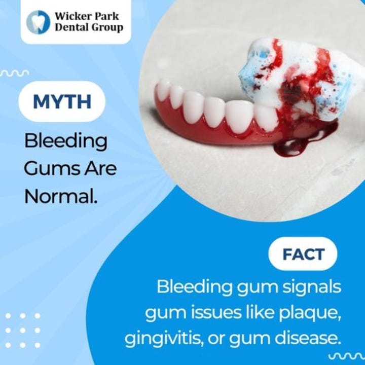 Understanding the Two-Step Process of Root Canal Treatment 🦷 - Wicker ...