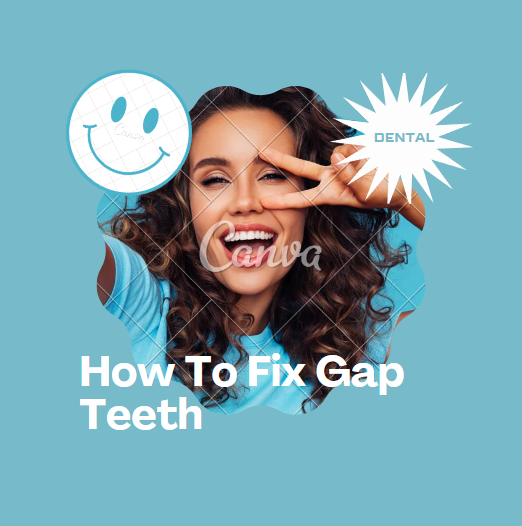 What Is Gap Teeth? - Dr. Abdul Raheem - Medium