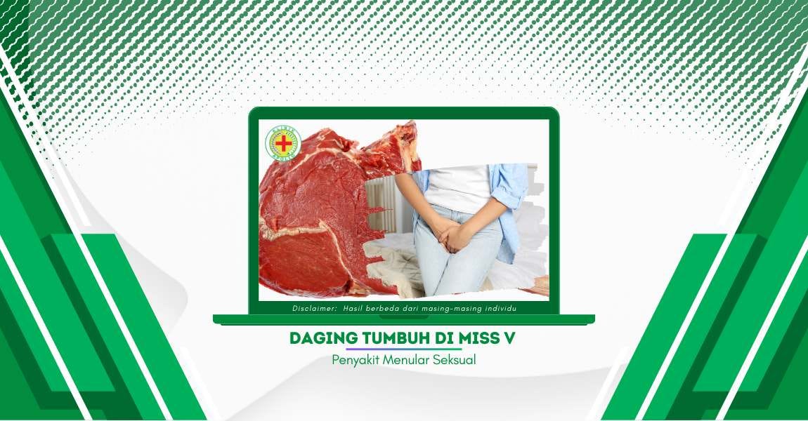 Inilah Dia 3 Jenis Terapi Disfungsi Ereksi yang Efektif | by Yusron Gunawan | Mar, 2024 | Medium