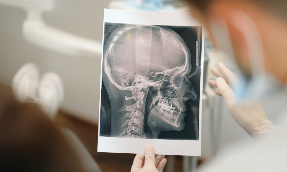 A Comprehensive Radiologist Guide to Lordotic Chest X-rays | by HSIN ... A Comprehensive Radiologist Guide to Lordotic Chest X-rays | by HSIN ...