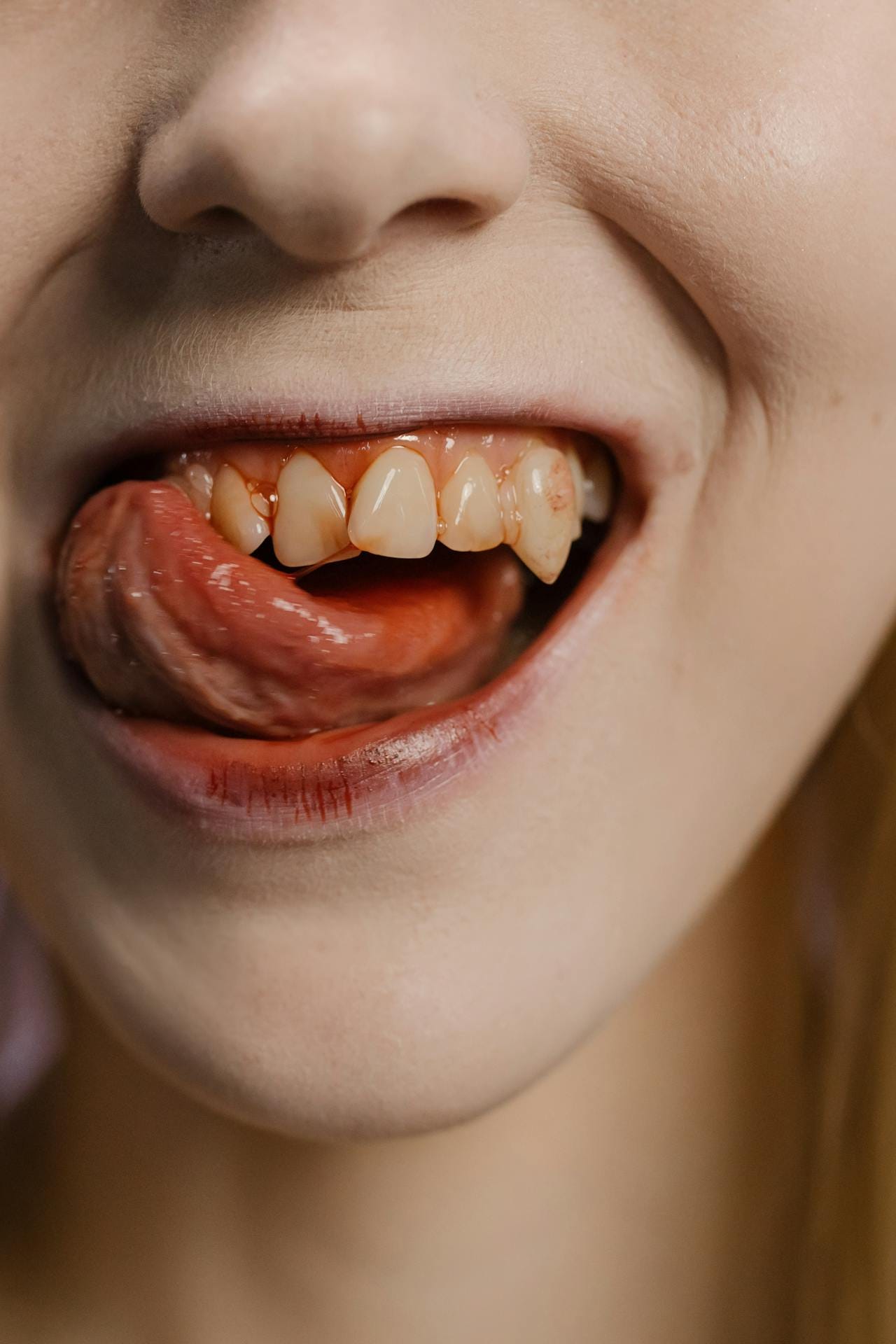From Stain to Stress: The Causes and Psychological Impact of Tooth ...