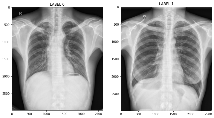 Counting Objects in OpenCV. | by Victor Olufemi | Medium