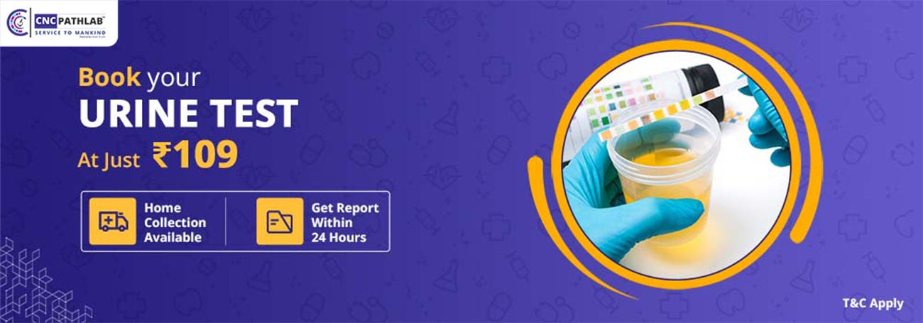Best Urine test In Delhi - cncpath lab - Medium