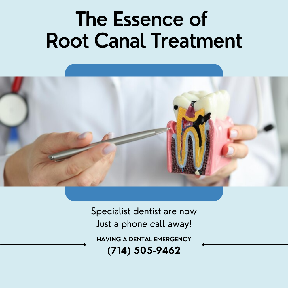 Common Signs You Need a Root Canal | by Larwin Square Dentistry Tustin ...