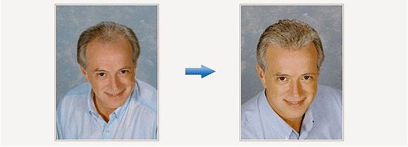 Hair Replacement Systems for Natural Fuller Hair Style | by Hair ...
