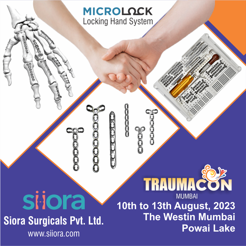 What is External Fixation? - Siiora Surgical - Medium