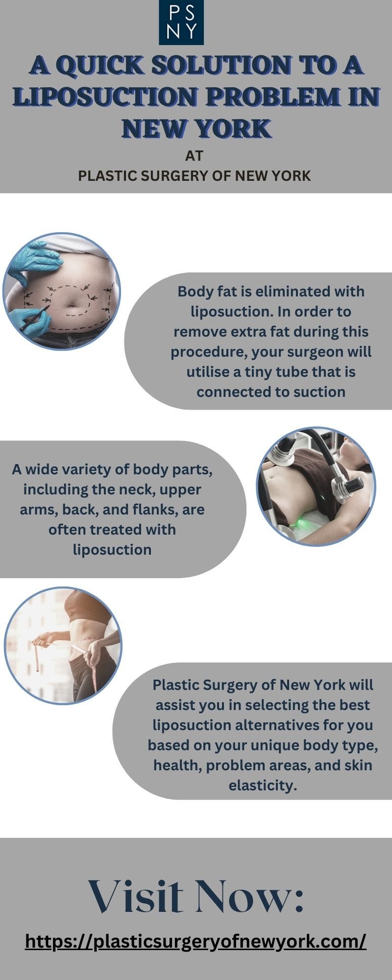 Best Liposuction In New York - Plastic Surgery of New York - Medium