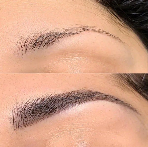 Busting Myths About Scalp Micropigmentation - Jessica Cram - Medium