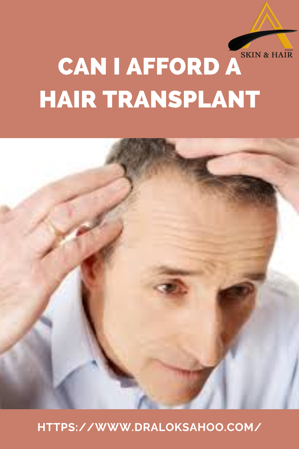 When can I touch my transplanted hair? — Dr Alok Sahoo - Dr Alok Sahoo ...