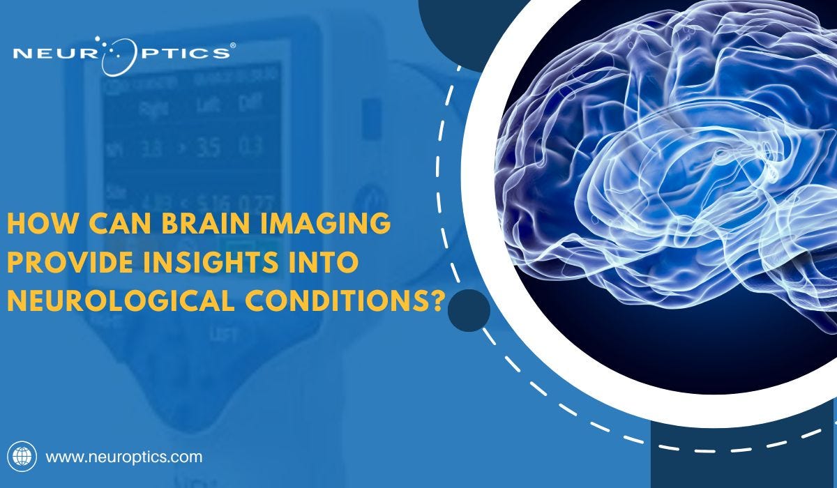 Exploring the Neurological Pupil Index in Neuro Exams | by NeurOptics ...