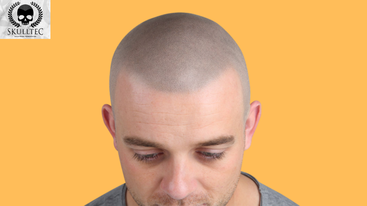 Micropigmentation with Hair: Comprehensive Guide | Medium