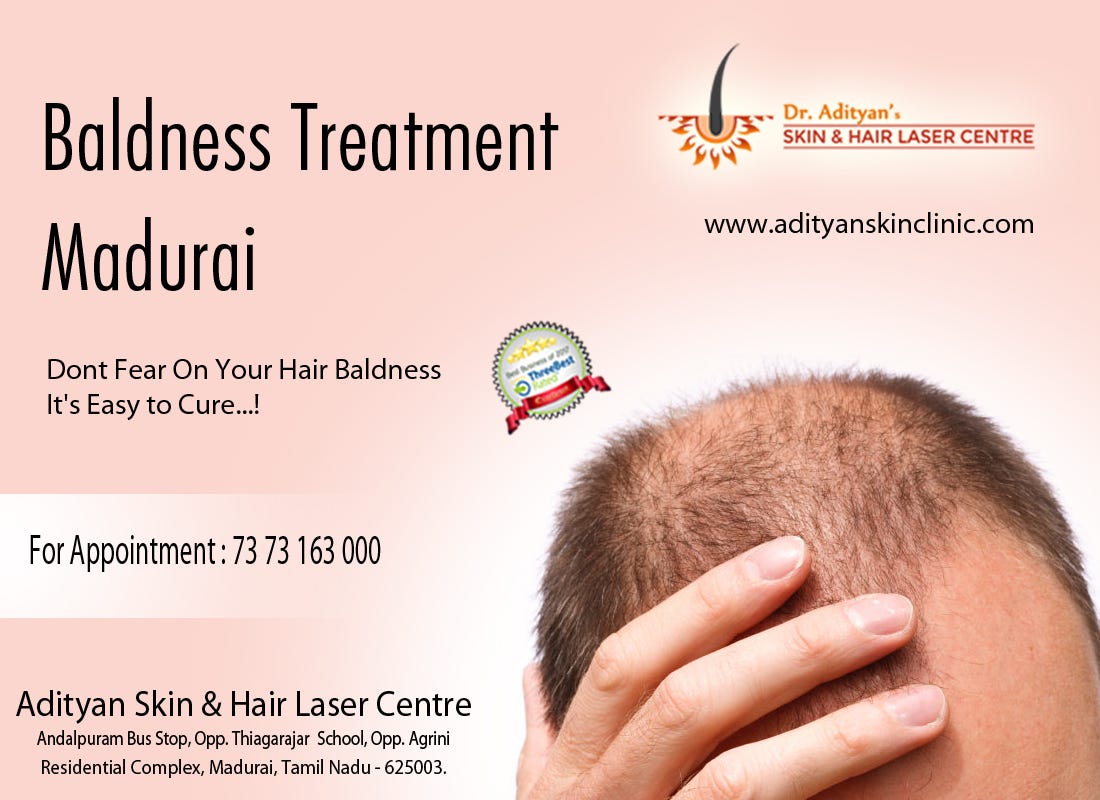 3 Major Reasons For Baldness And The Best Baldness Treatment Madurai ...