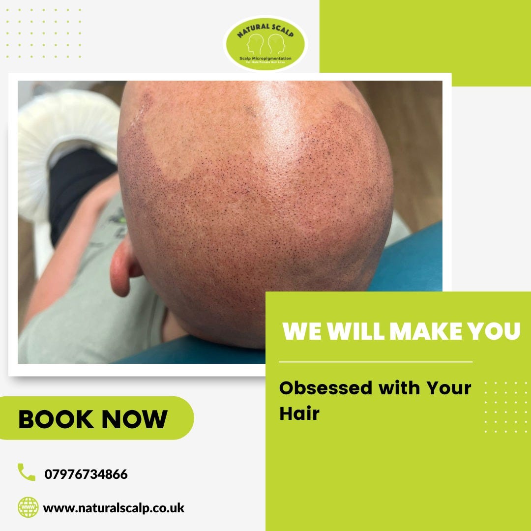 Female Scalp Micropigmentation in the UK: Empowering Women Through Hair ...