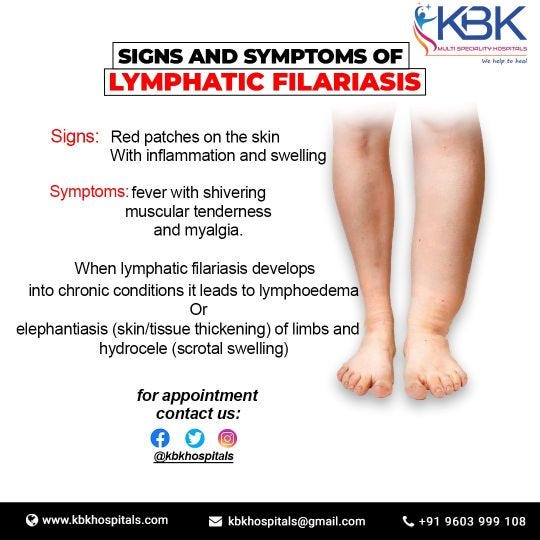 Filariasis Wound Treatment. Why Choose KBK Multispeciality… | by KBK ...