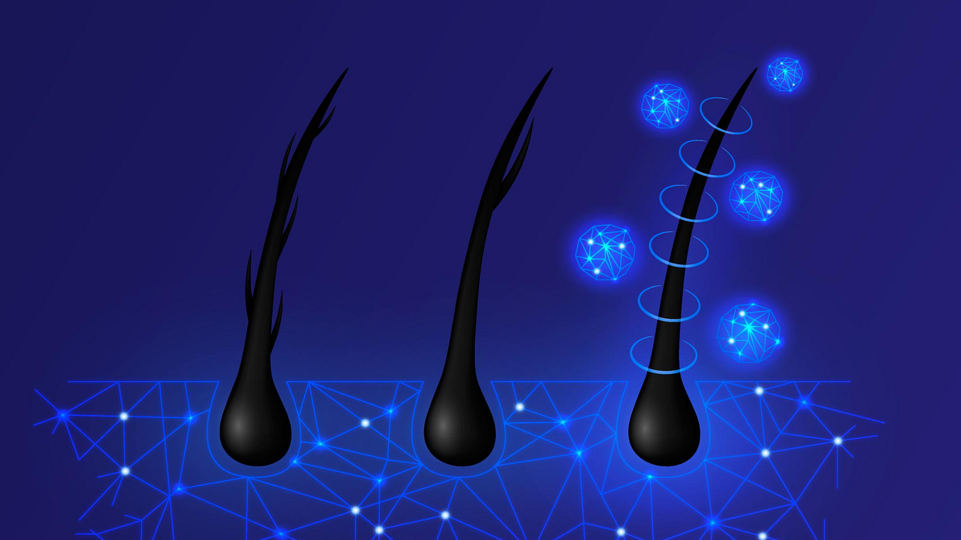 Understanding Hair Loss and FUE Hair Transplant: Key Insights | by ...