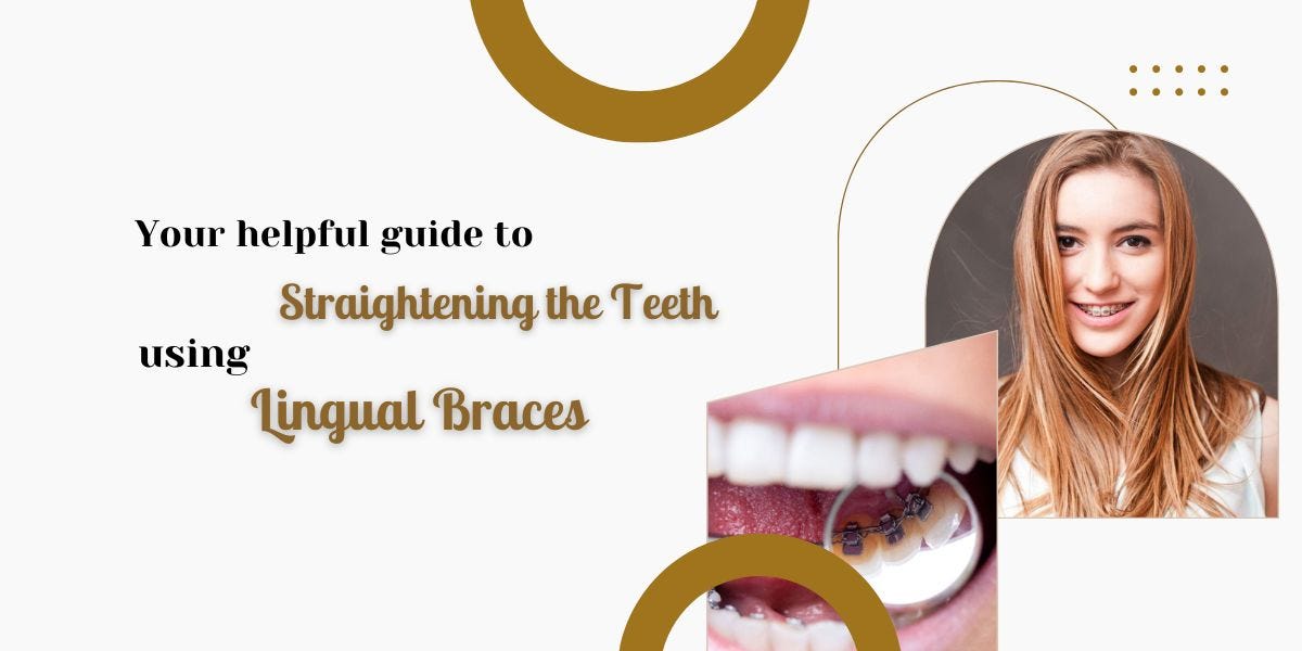 A Guide To Lingual Braces | Lingual Braces: What Are the Advantages and ...