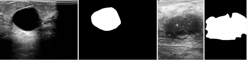 Creating and training a U-Net model with PyTorch for 2D & 3D semantic ...