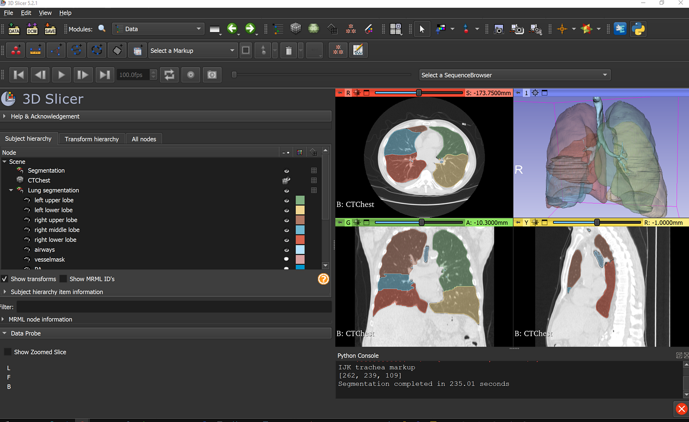 An Introduction to 3D Slicer. A brief overview of an open source… | by David Simms | Medium