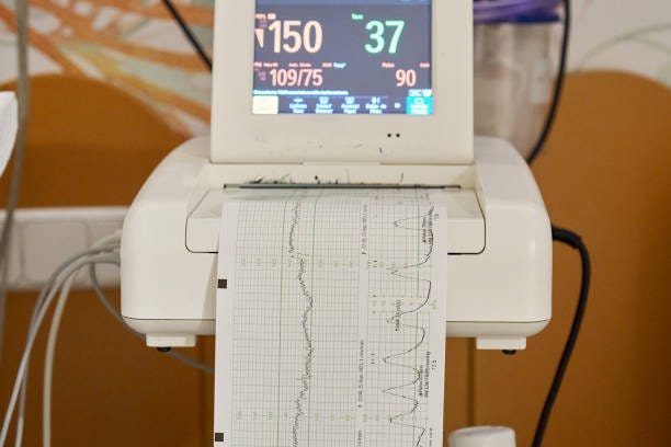 Understanding the Importance of Proper 12 Lead Placement for ECG ...