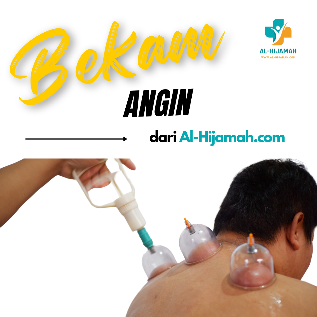 Kebaikan Bekam Sunnah. Bekam sunnah merupakan salah satu… | by al hijamah | Apr, 2024 | Medium