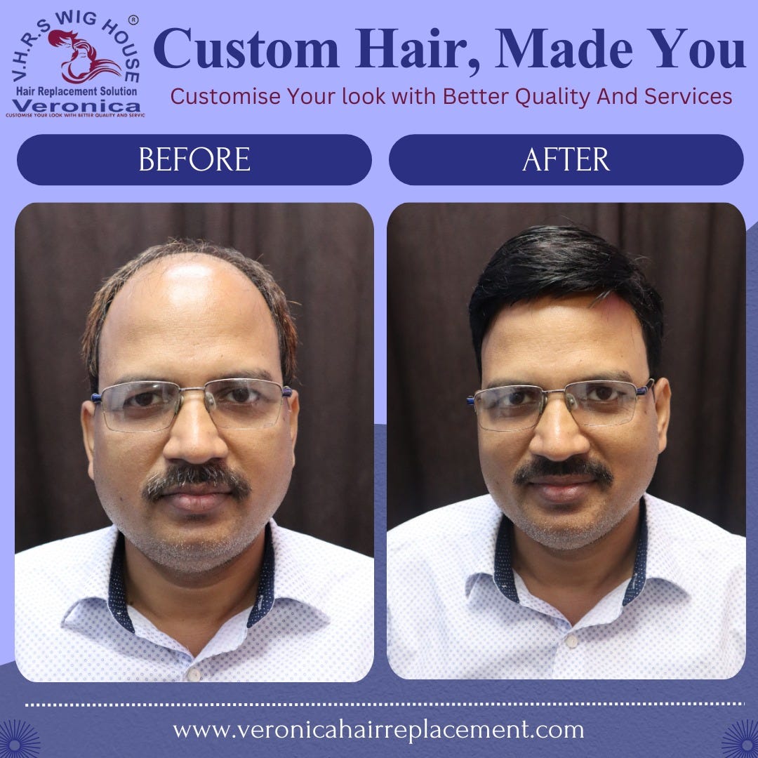 Hair Patch & Wigs Fixing | Veronica Hair Replacement Solution | by ...