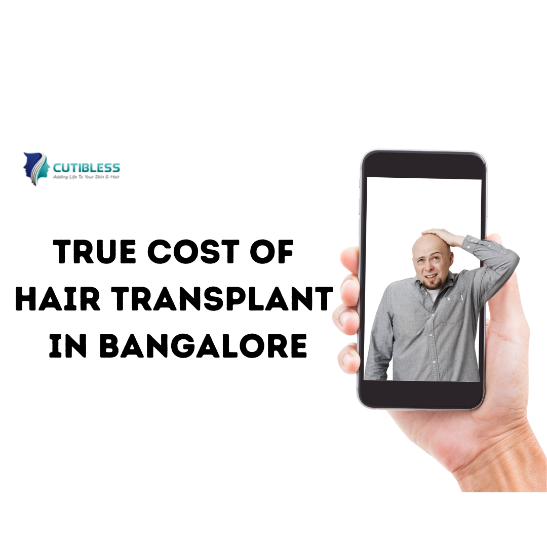 Understanding Hair Loss and FUE Hair Transplant: Key Insights | by ...