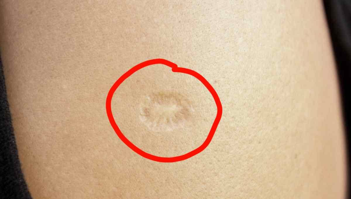 How to Use Castor oil for Skin Tightening? | by Melissa Williams | Medium