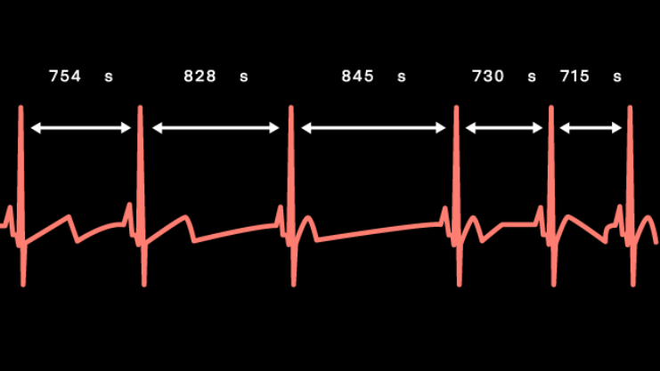 Threat Hunting And Detection With Web Proxy Logs By Mehmet Ergene