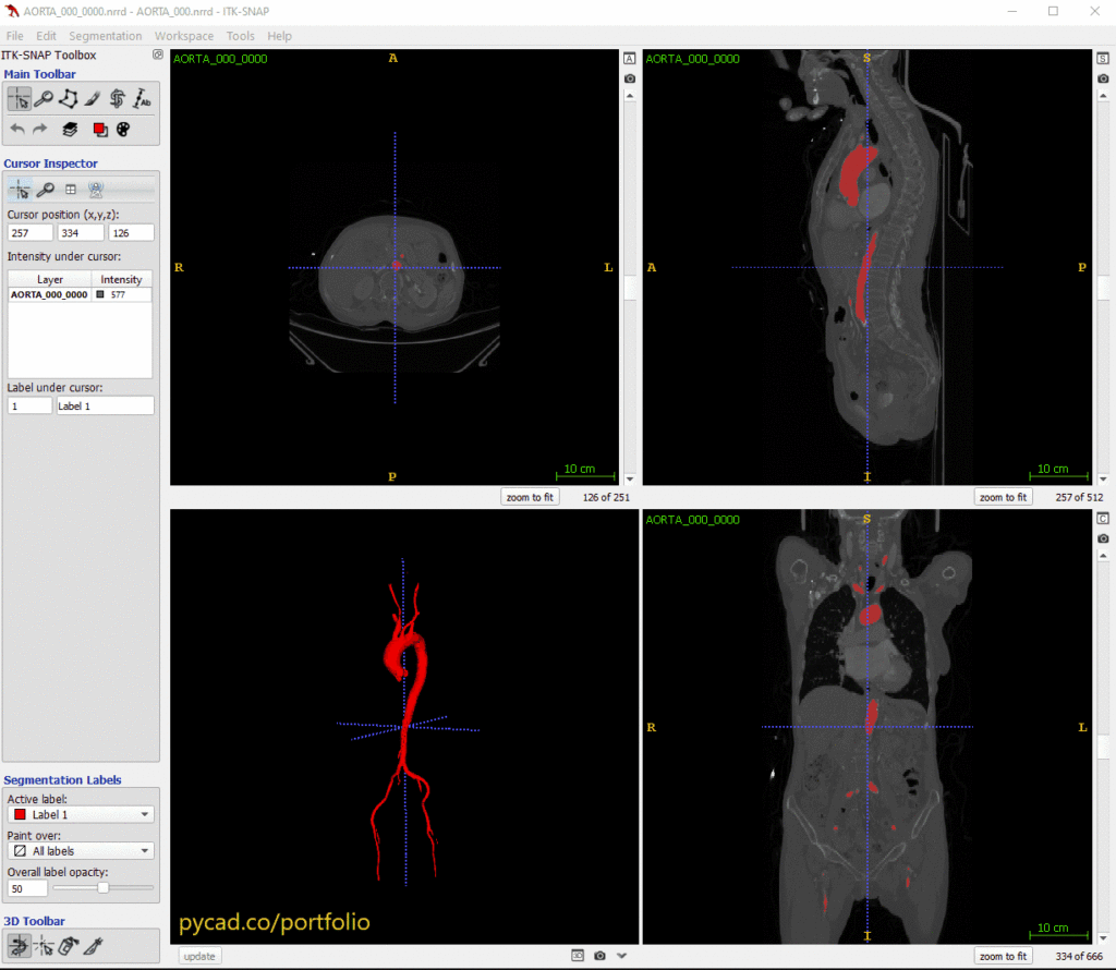 How to Process 3D Medical Imaging Data using Python and SimpleITK | by Nour Islam Mokhtari ...