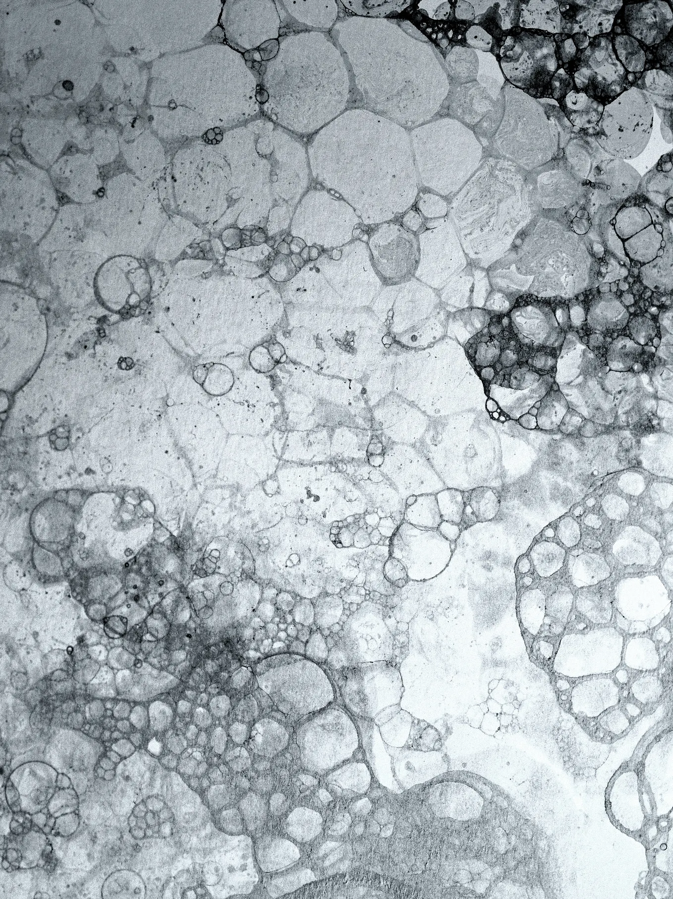 Back Propagation Algorithm Numerical Solved By Sujan Karna Medium