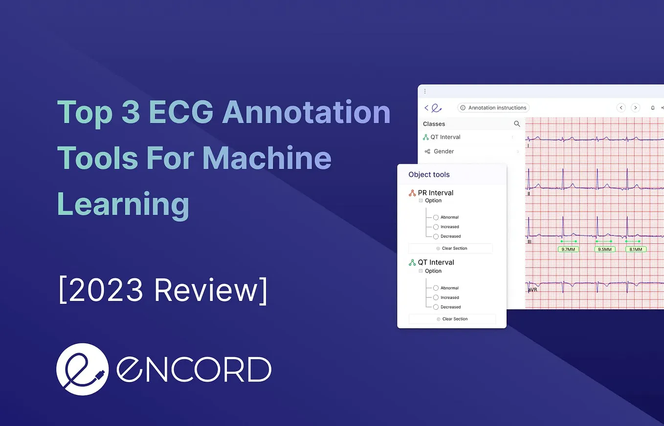 Yolov8 For Object Detection Explained Practical Example By Encord