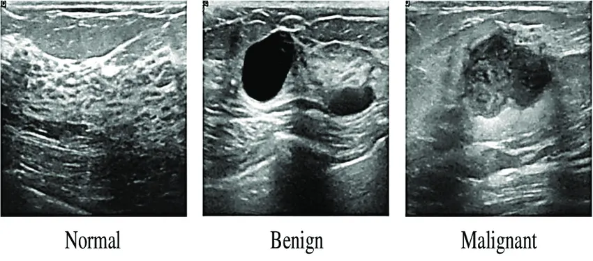 Action Recognition Using Pose Estimation With Tf Openpose By Shoeb Ahmad By Shoeb Ahmad Medium
