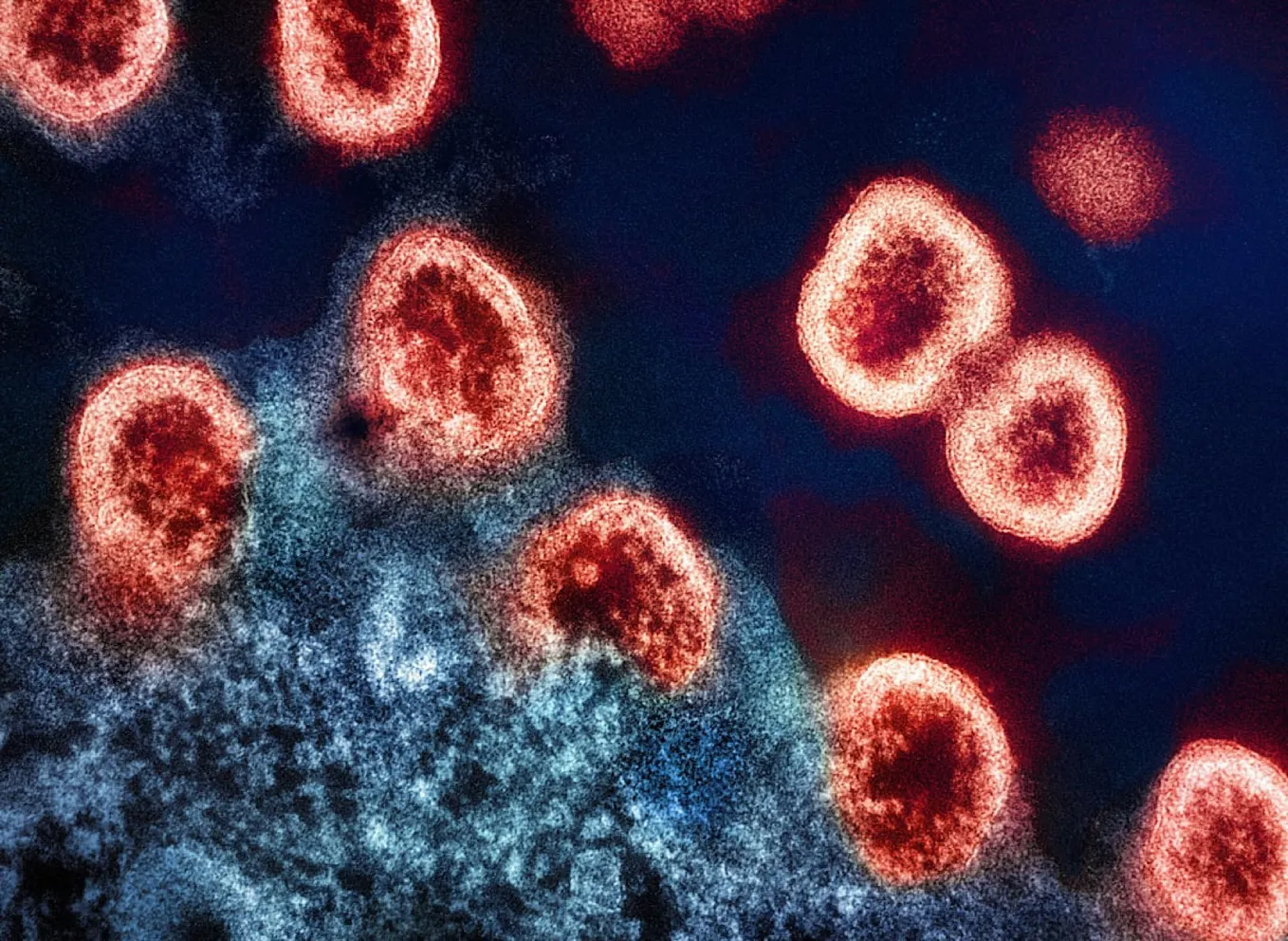 Triple Negative Breast Cancer. The Subtype That Demands Our Attention ...
