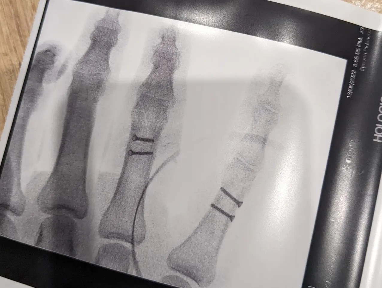 Decoding Netflix: An In-Depth Look at the Tech Stack Powering the Streaming Giant | by Love ...