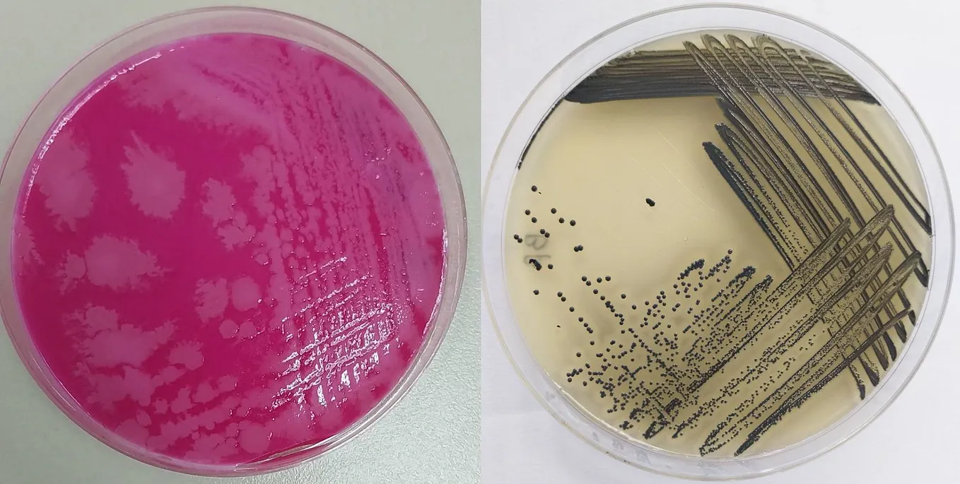 Triple Sugar Iron (TSI) agar. ปิยะรัตน์ จิตรภิรมย์ | by Piyarat ...