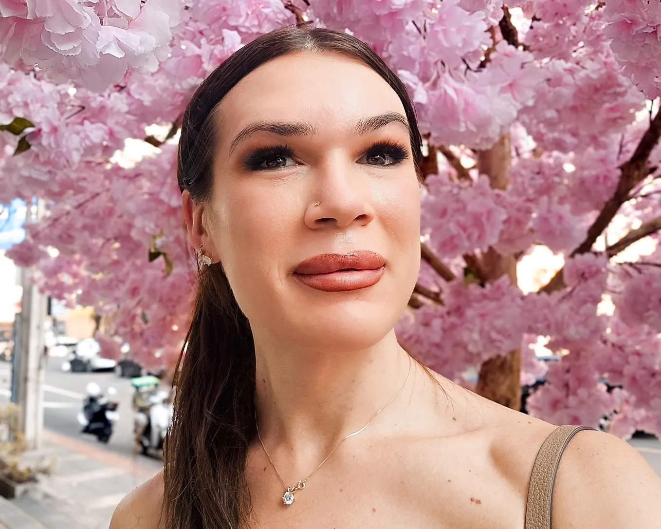 Fat Redistribution in Trans Women: What the Science Tells | by Kira Ry ...