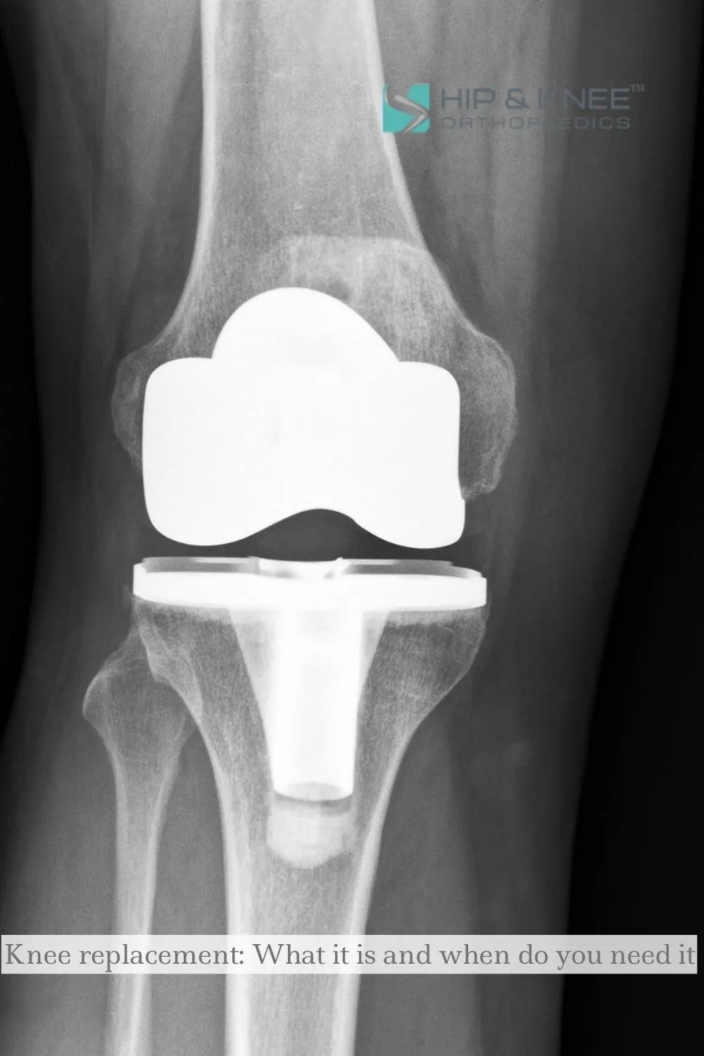 Back Pain at Work: Preventing Pain and Injuries | by Hip & Knee ...