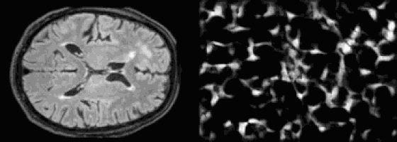 Generating Medical Images with MONAI | by Walter Hugo Lopez Pinaya ...