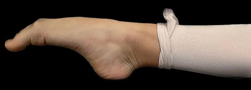 Improving the feet for ballet. Before we talk about how to improve the ...