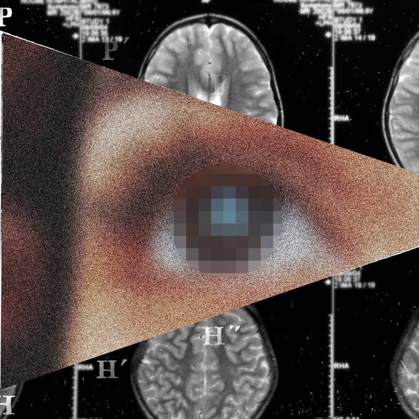 Preprocessing EEG Data for ML Model Use | by Amina Kalandarova | Medium