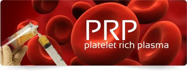 When PRP and Dermal Fillers Combine, Magic Happens | by Red Bamboo Medi ...