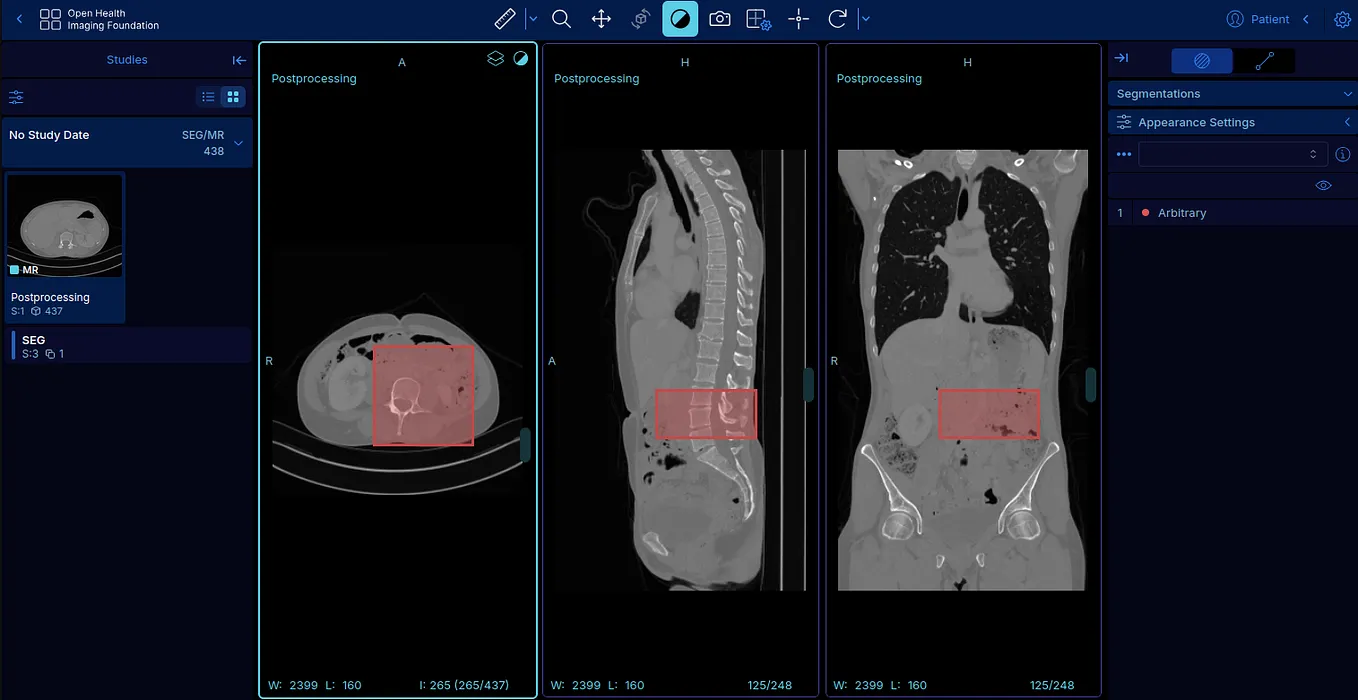 How To Use Custom Or Official YOLOv8 Object Detection Model In ONNX ...